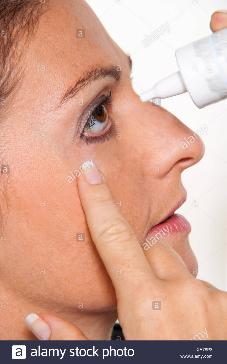 Allergic Reaction Eye High Resolution Stock Photography and Images - Alamy