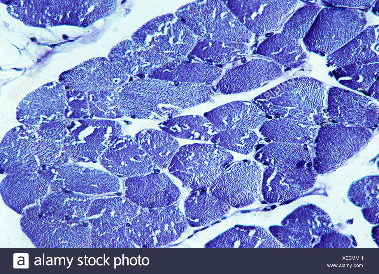 Skeletal Striated Muscle Stock Photos & Skeletal Striated Muscle Stock ... Skeletal Striated Muscle Stock Photos & Skeletal Striated Muscle Stock ...