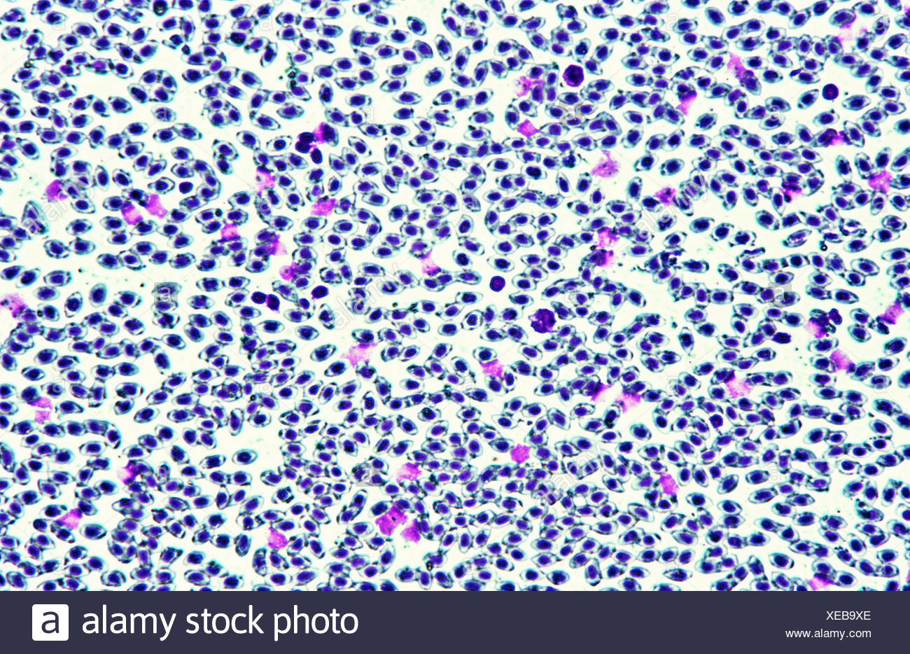 Blood Smear Microscope High Resolution Stock Photography and Images - Alamy