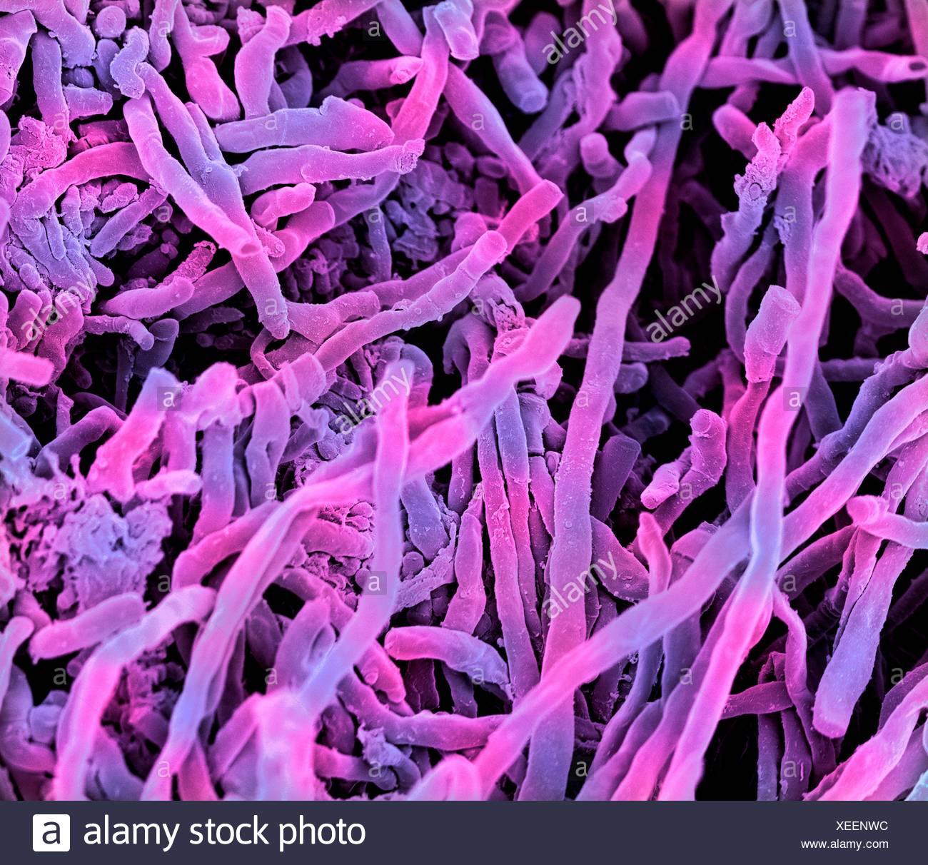 Streptomyces High Resolution Stock Photography and Images - Alamy