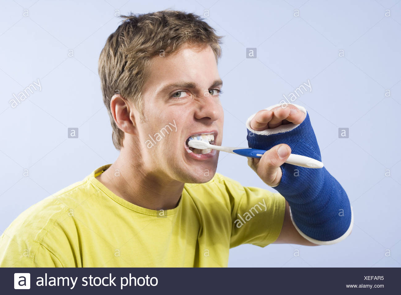 Fracture Arm High Resolution Stock Photography and Images - Alamy