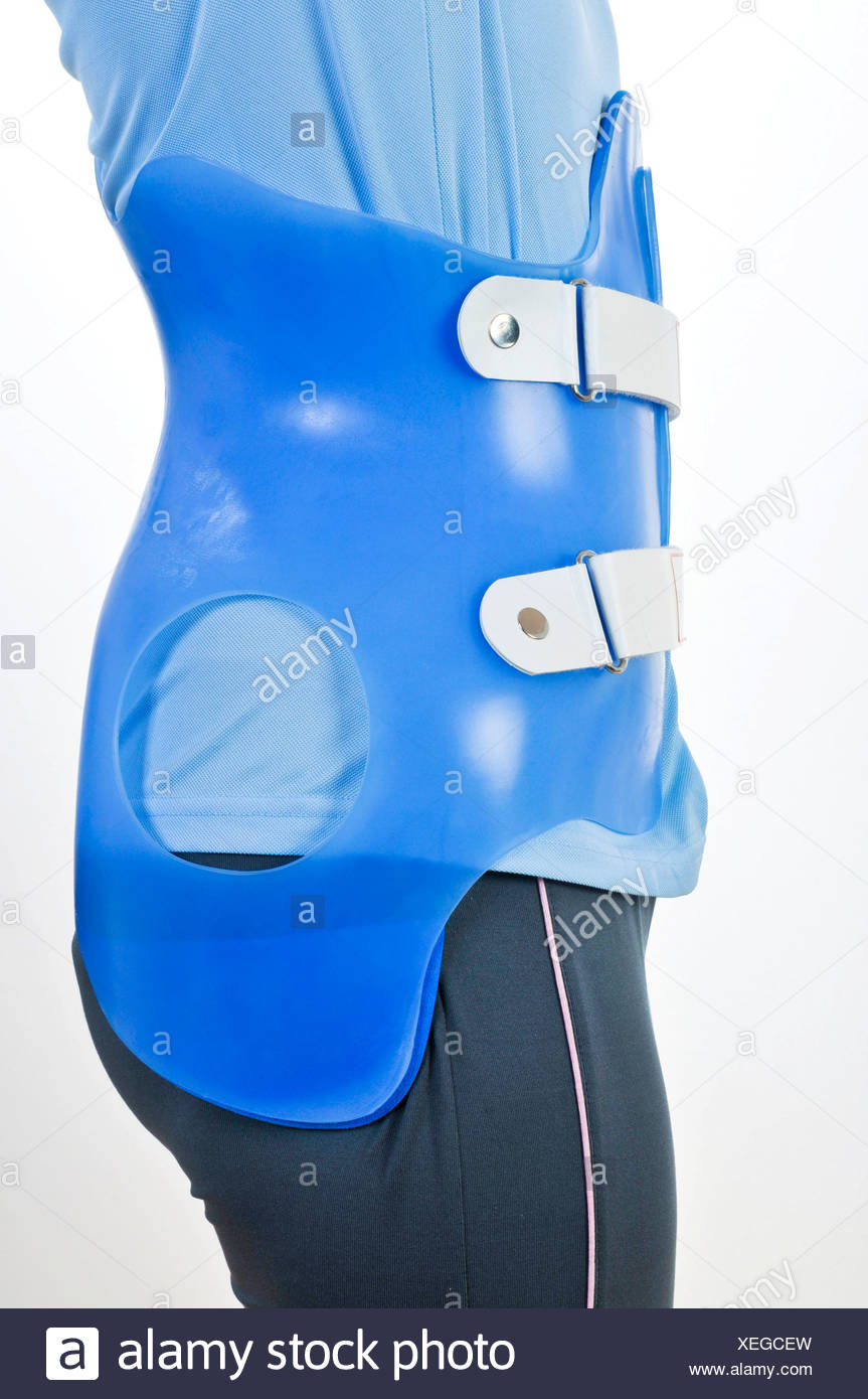 Girl Wearing Chenau Scolioses Corset High Resolution Stock Photography ...