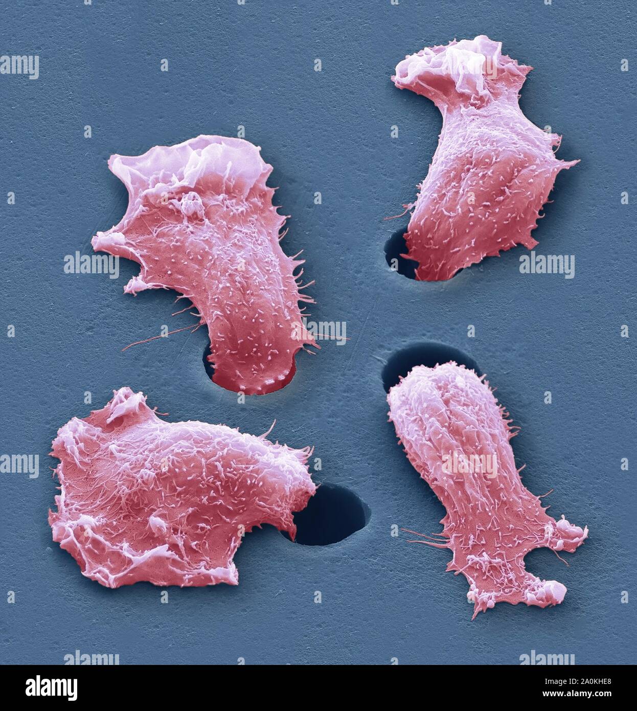 Sarcoma cells -Fotos und -Bildmaterial in hoher Auflösung – Alamy