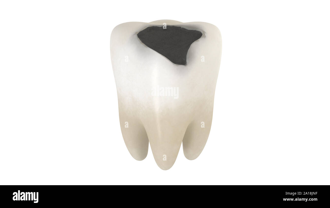 Gebiss anatomie zeichnung -Fotos und -Bildmaterial in hoher Auflösung ...