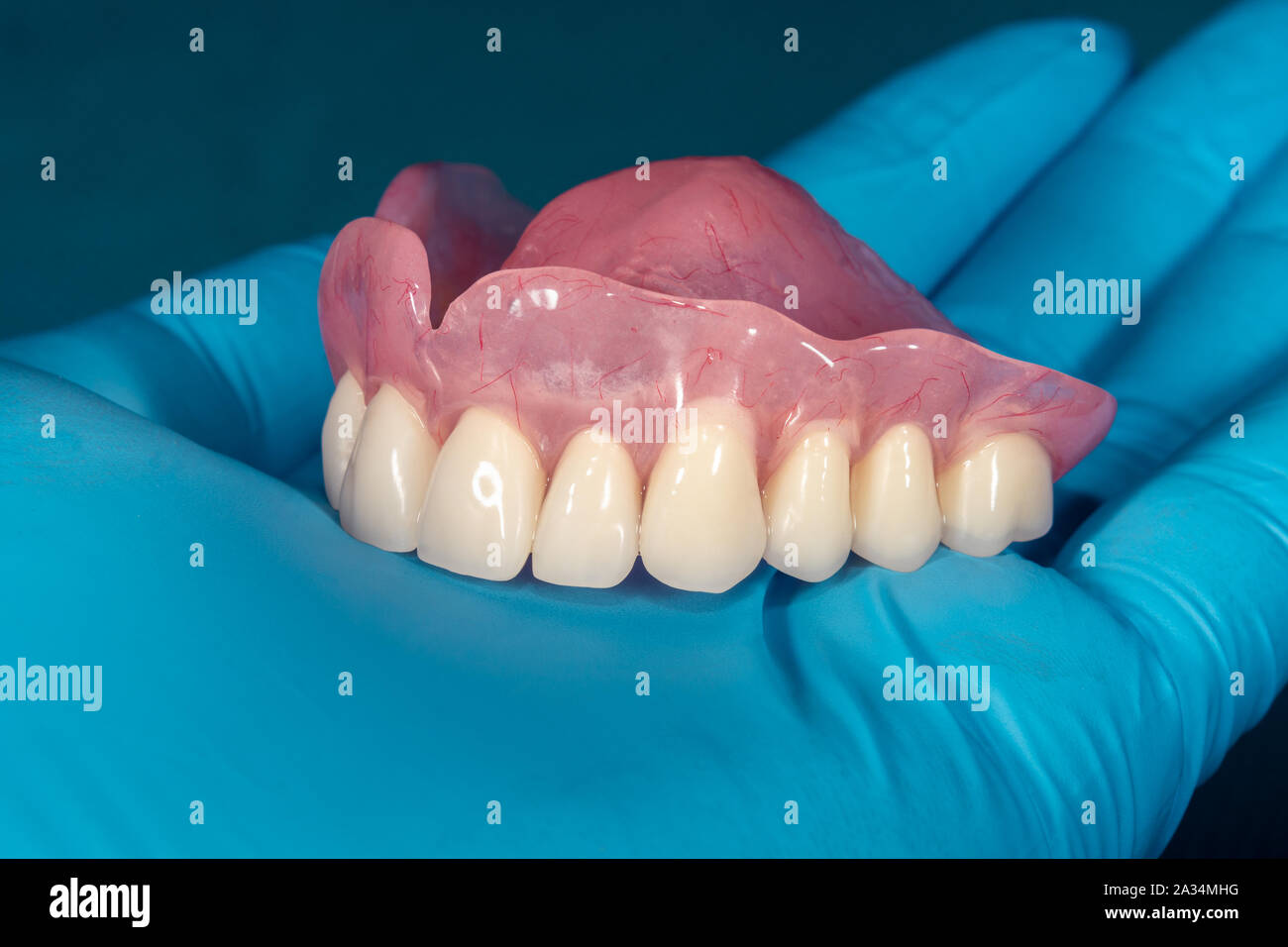 Zahnprothese. Volle herausnehmbare Prothese des Oberkiefers der Mann ...