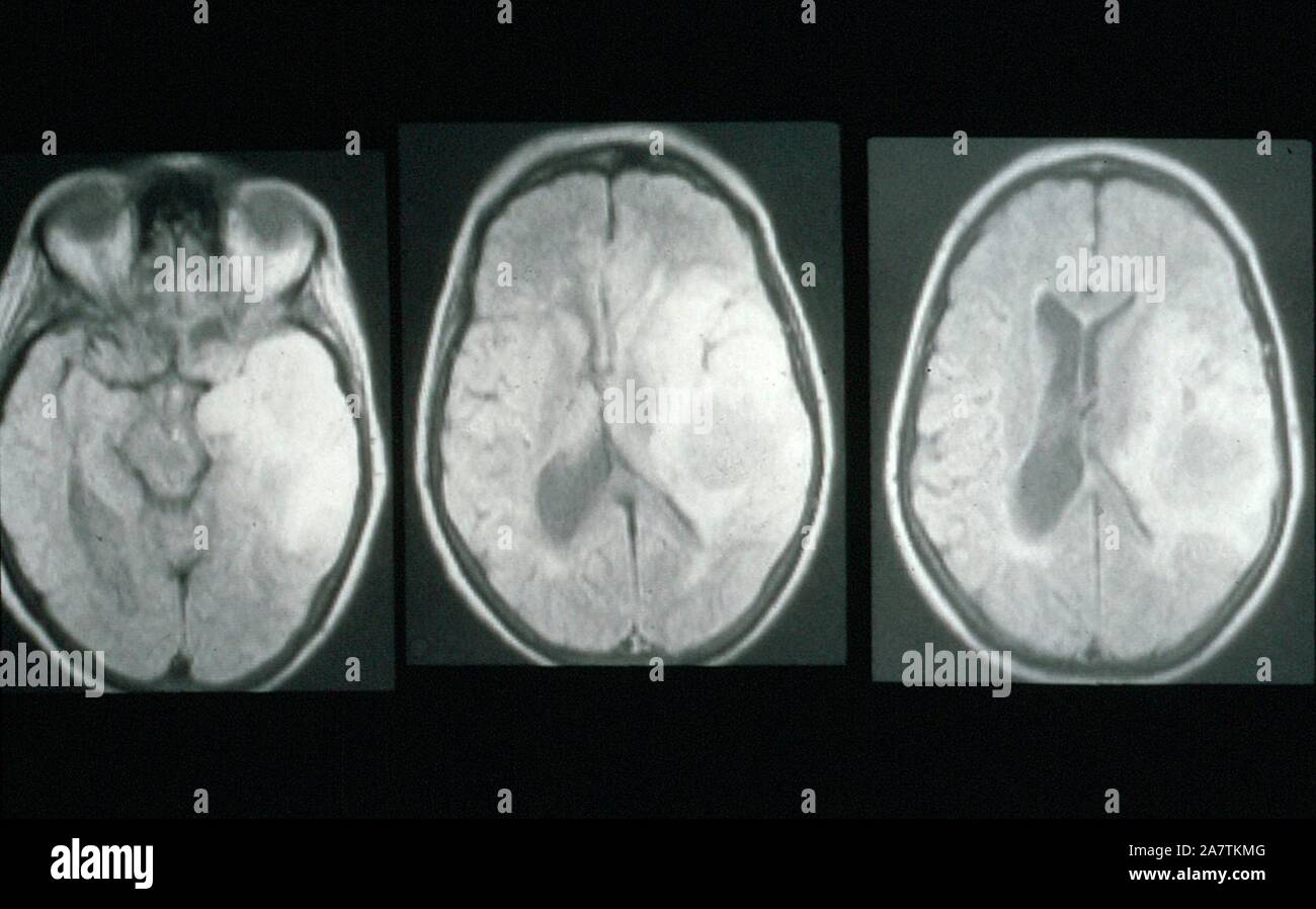 Gehirn ct scans -Fotos und -Bildmaterial in hoher Auflösung – Alamy