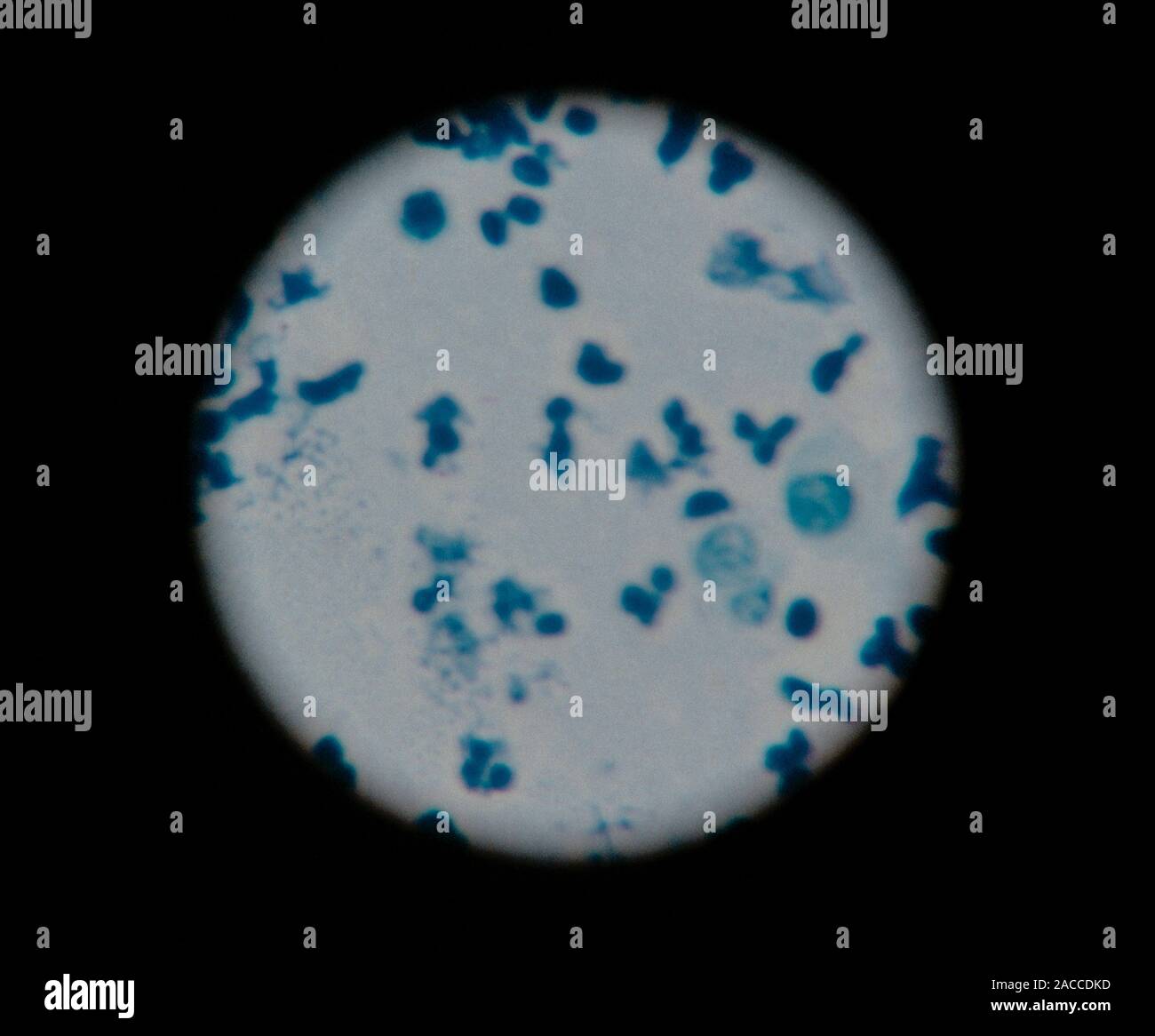 Petrischale Kultur übersicht Kolonien von Mycobacterium Tuberculosis ...