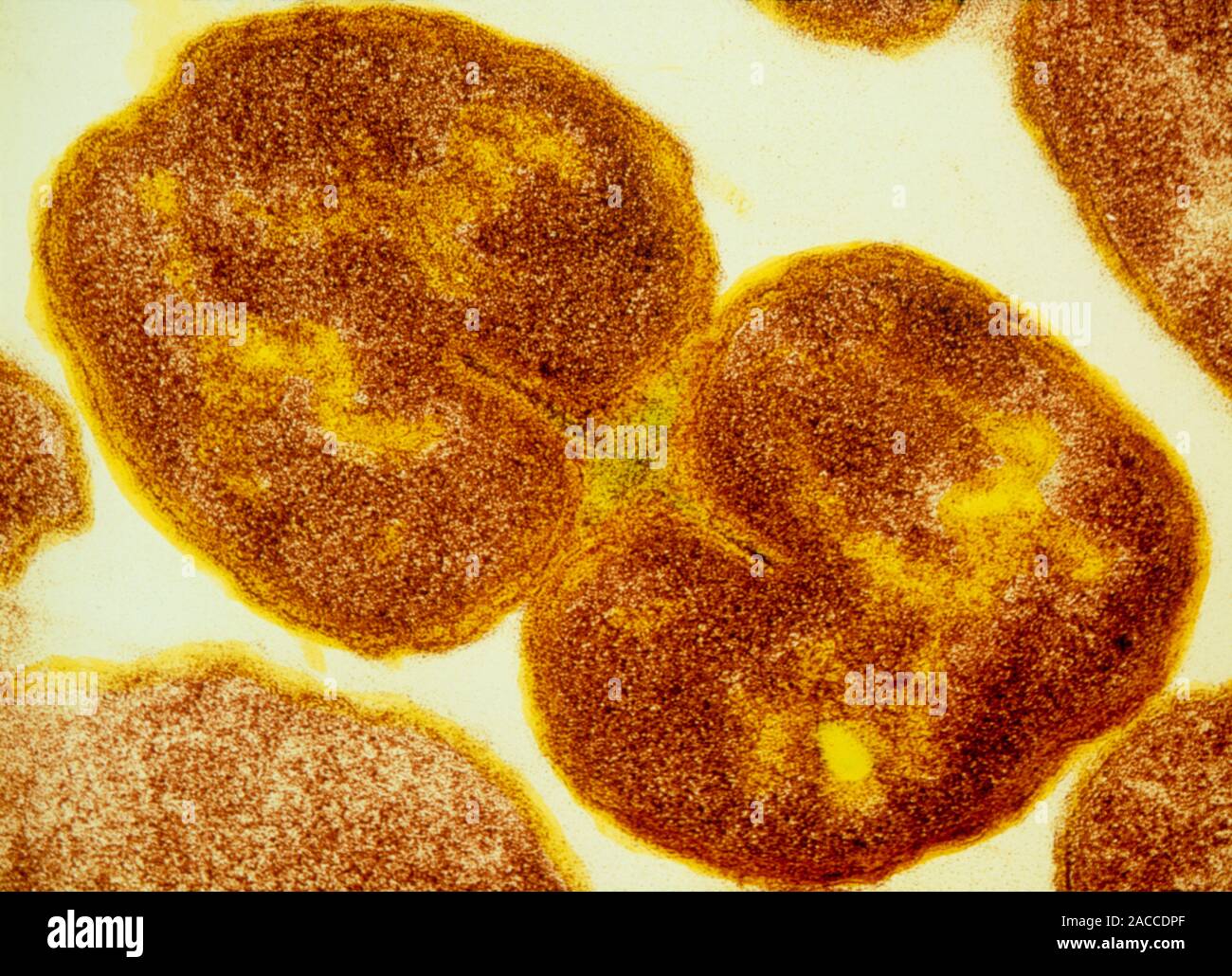 False - Farbe Transmission Electron Micrograph (TEM) von Neisseria ...