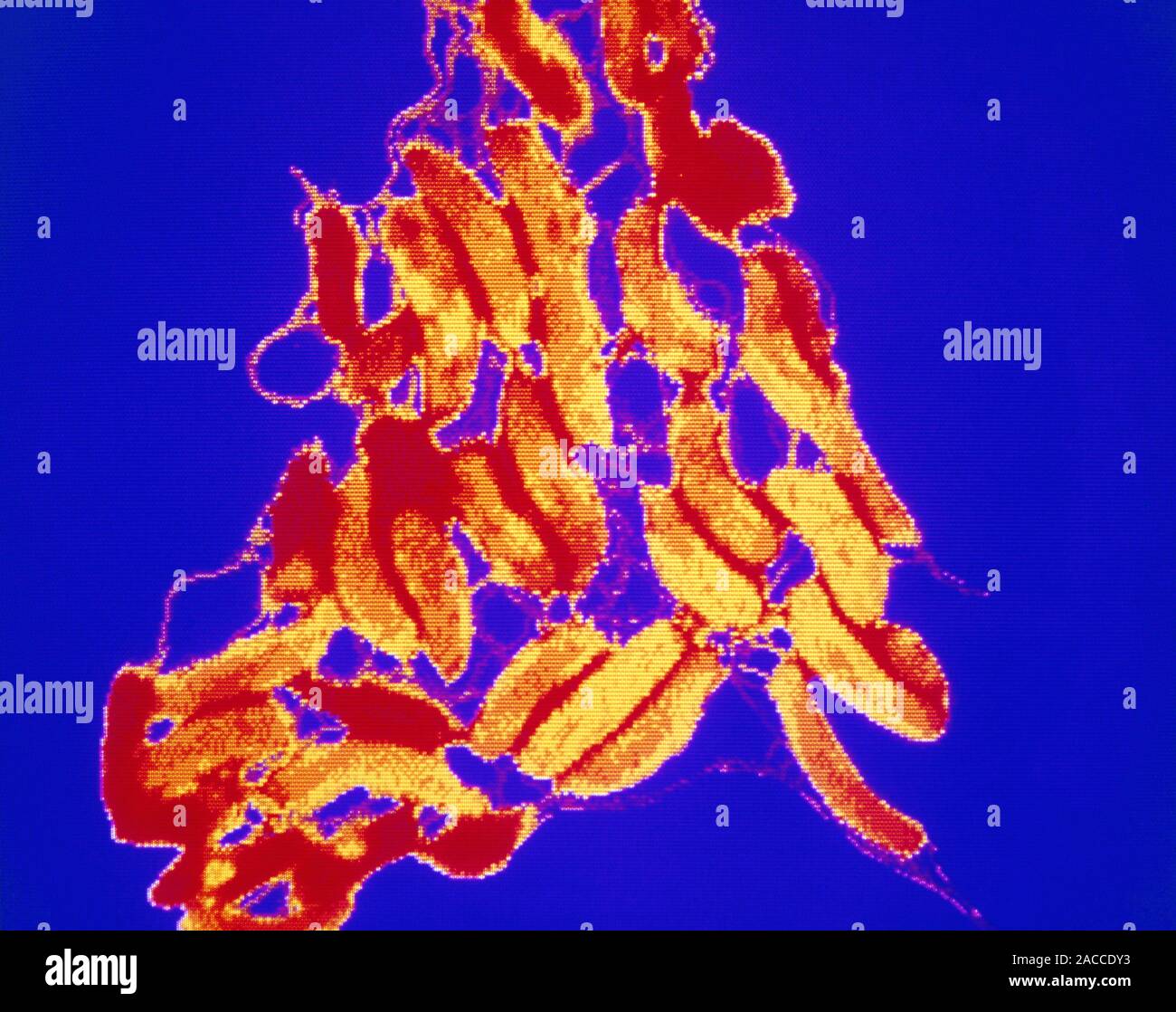 False - Farbe Transmission Electron Micrograph (TEM) einer Kolonie der ...