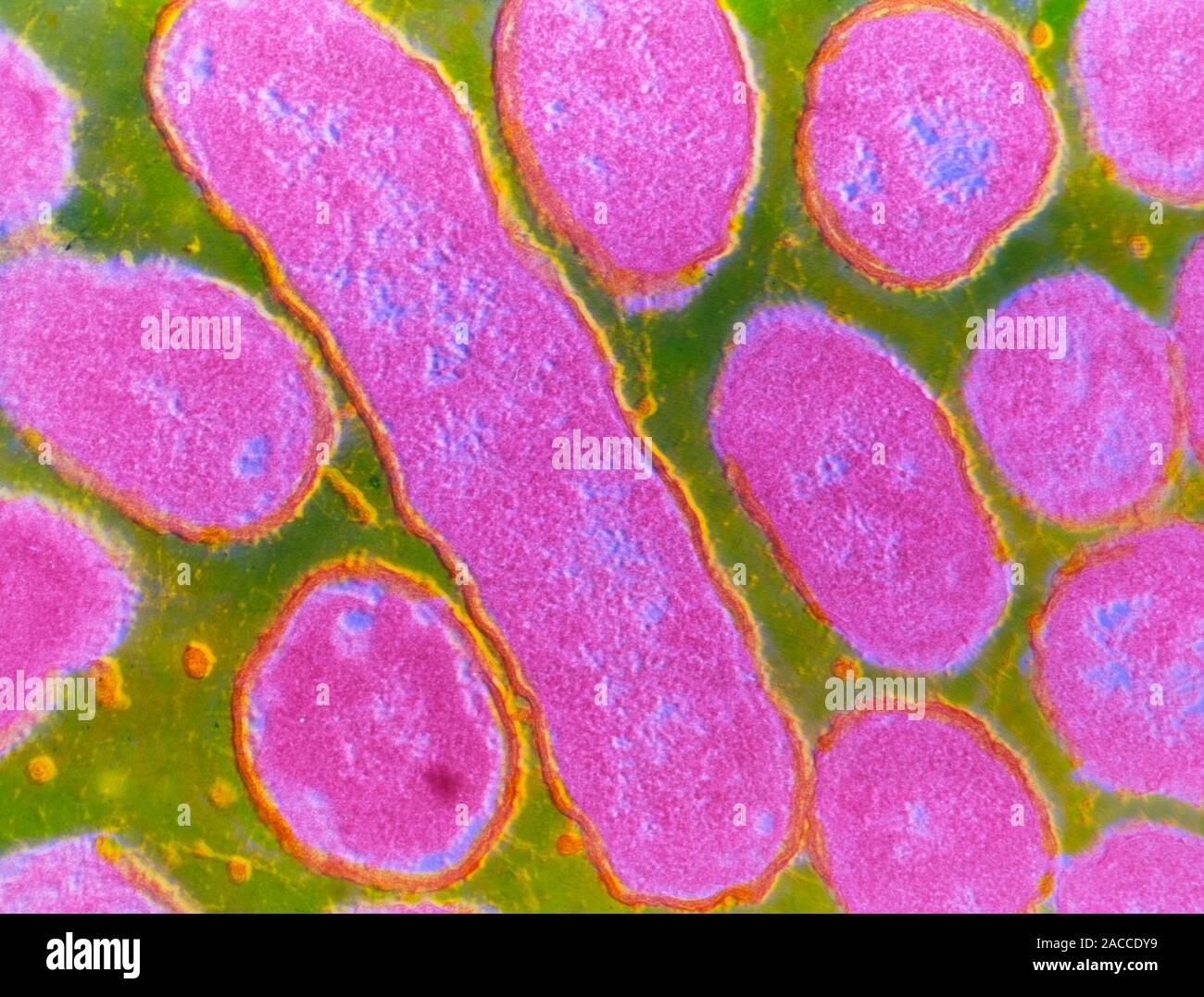 False - Farbe Transmission Electron Micrograph (TEM) Haemophilus ...