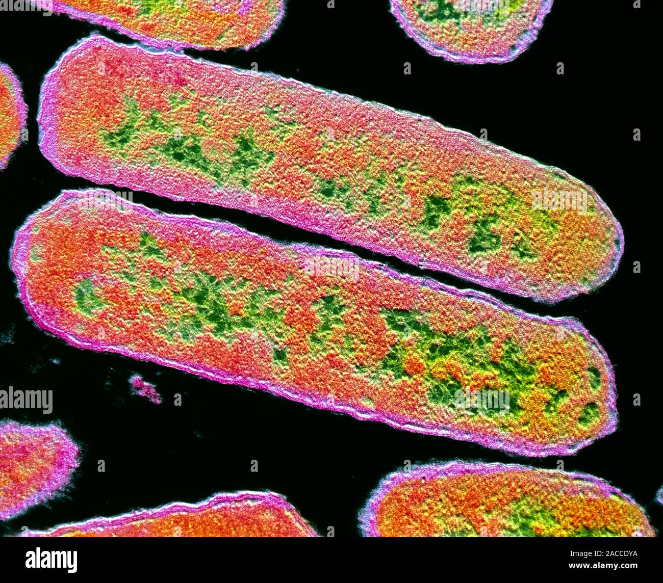 False - Farbe Transmission Electron Micrograph (TEM) Haemophilus ...