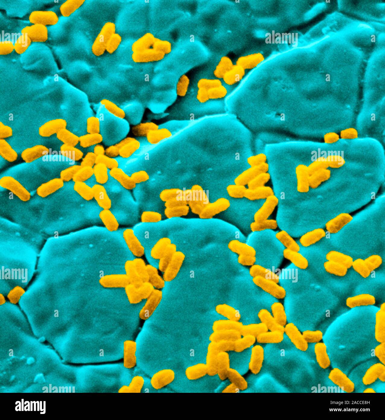 Salmonella enteritidis. Farbige Scanning Electron Micrograph (SEM) Der ...