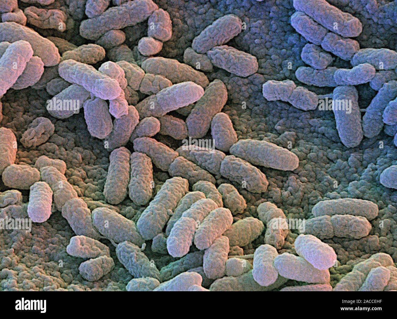 Salmonella enteritidis Bakterien. Farbige Scanning Electron Micrograph ...
