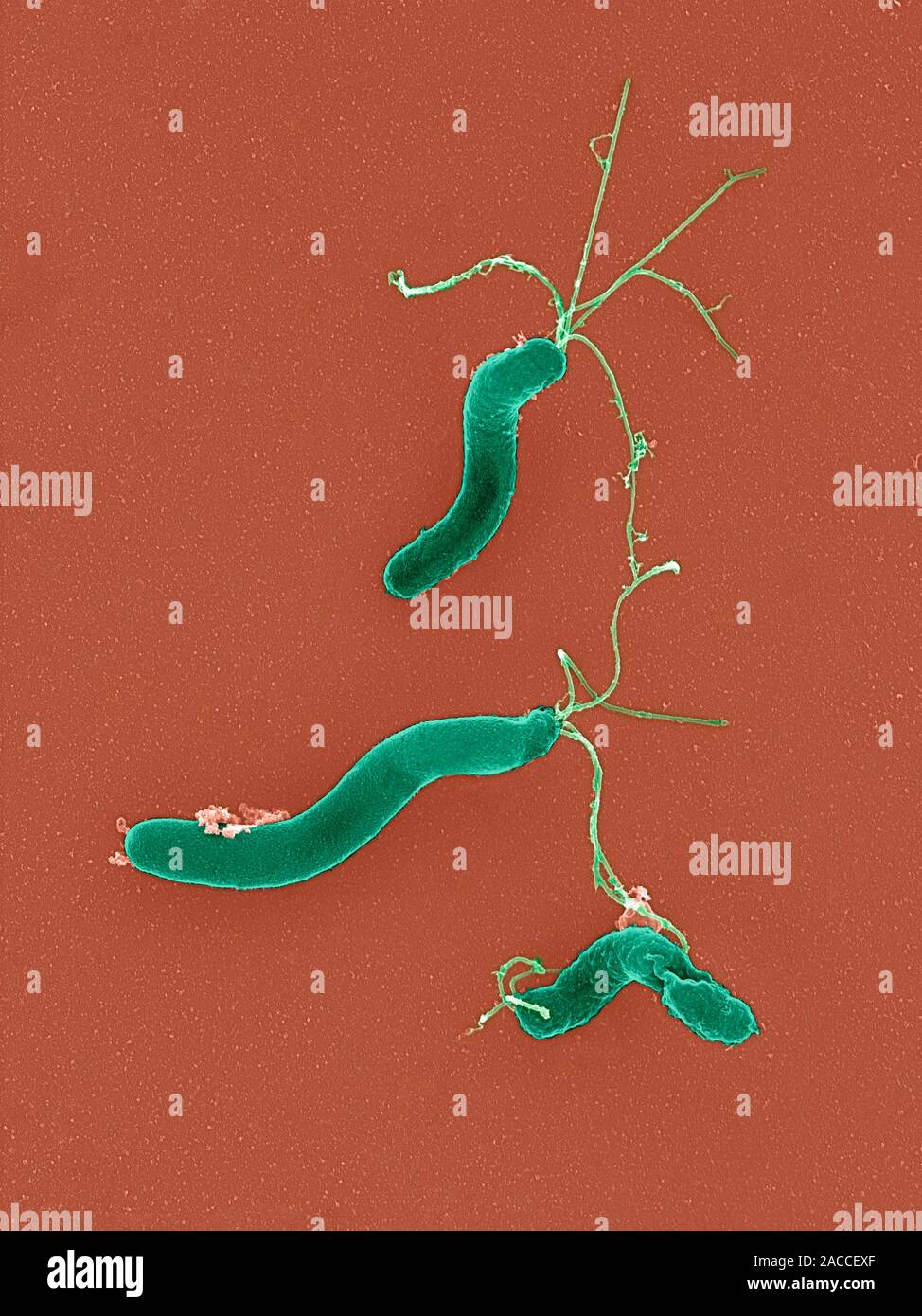 Helicobacter Pylori Bakterium. Farbige Scanning Electron Micrograph ...