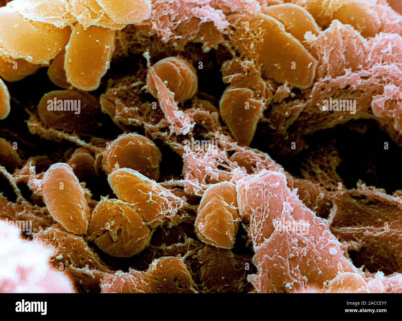 Bakterien Pest (Yersinia pestis), Farbig Scanning Electron Micrograph ...