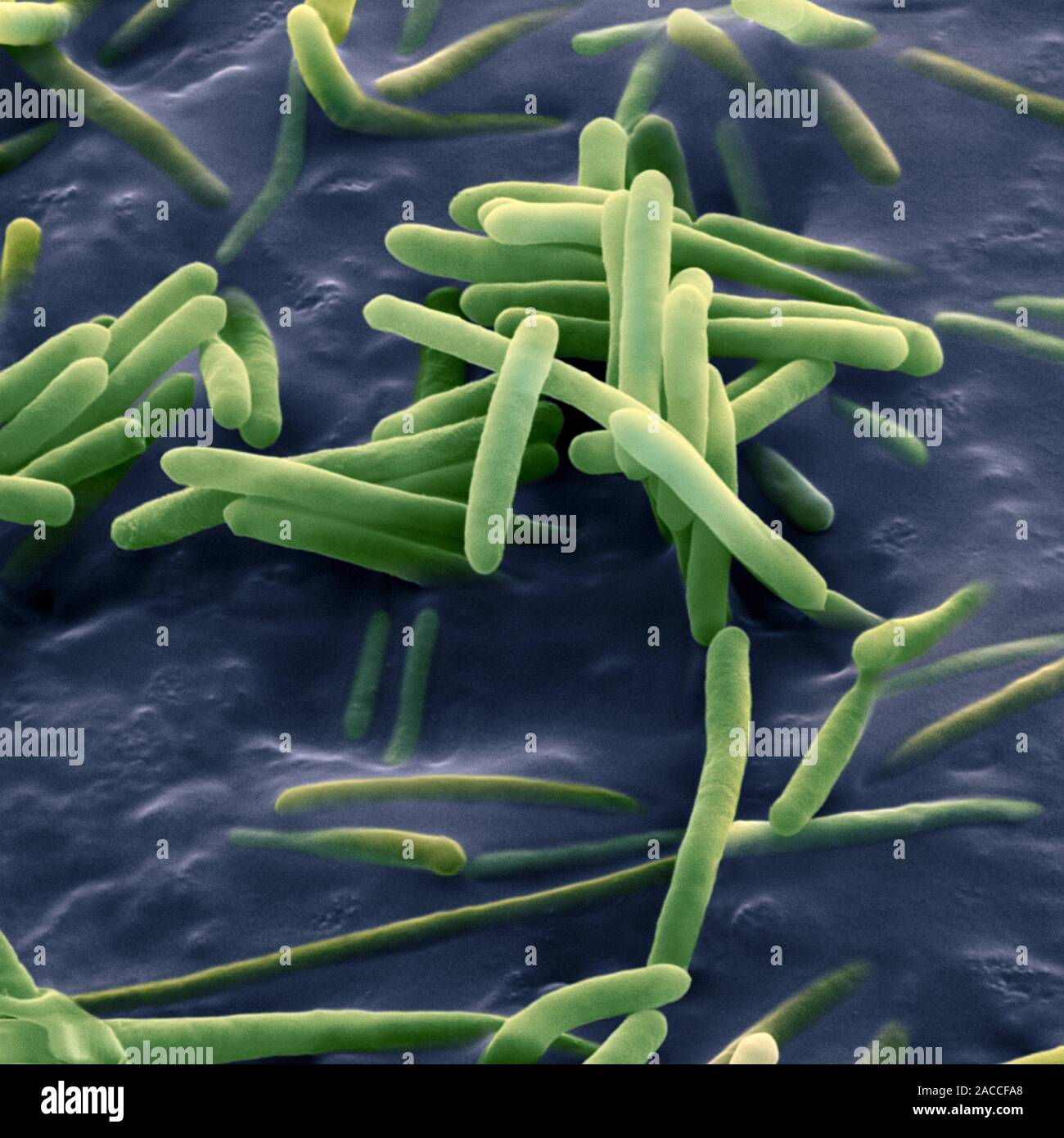 Bacillus sphaericus, Farbig Scanning Electron Micrograph (SEM). Diese ...