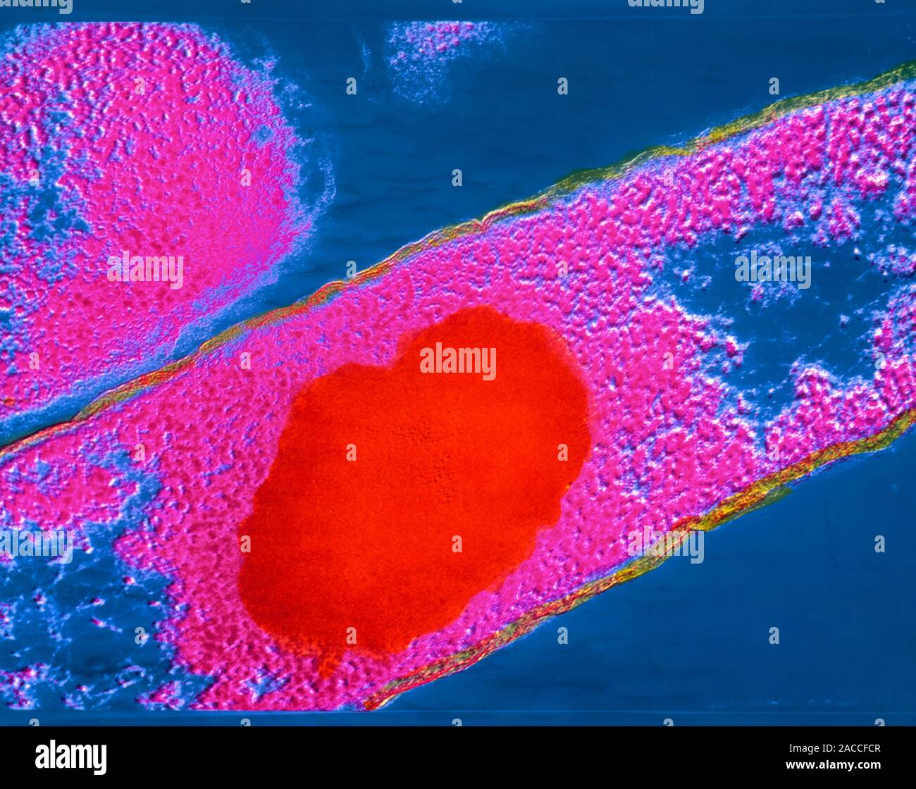 Transmission Electron Micrograph (TEM) des Bakteriums Escherichia coli ...