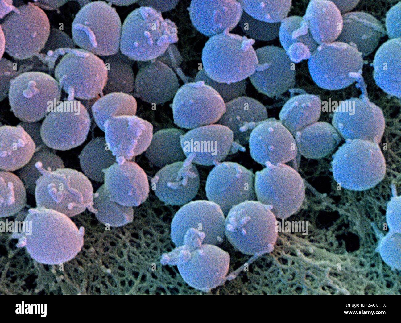 Staphylococcus aureus-Bakterien. Farbige Scanning Electron Micrograph ...