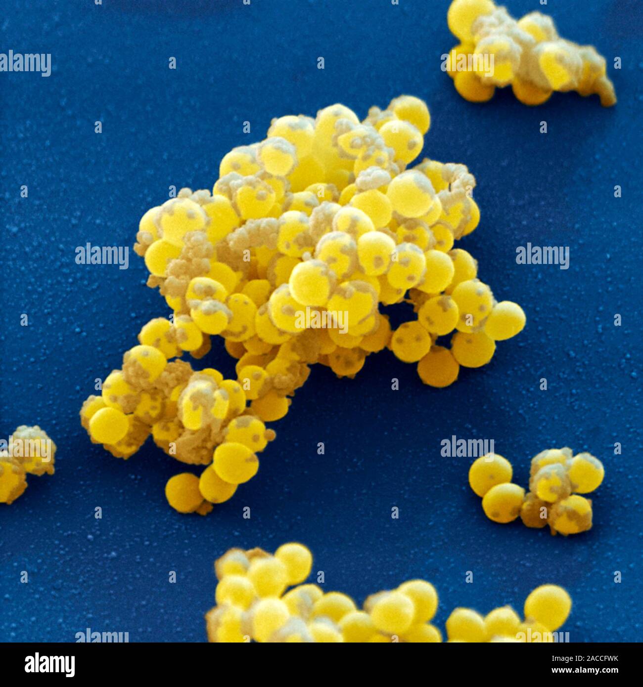 Staphylococcus aureus-Bakterien. Farbige Scanning Electron Micrograph ...