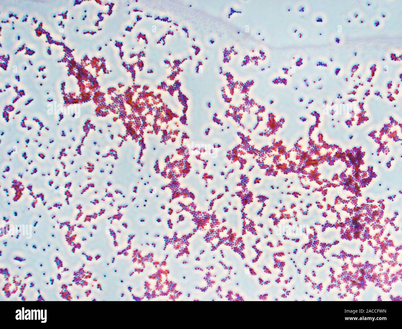 Staphylococcus aureus-Bakterien, Licht schliffbild. Diese Gram-positive ...