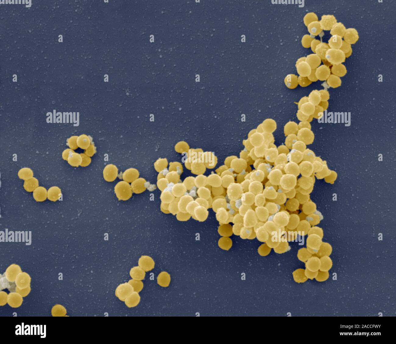Staphylococcus aureus-Bakterien, Farbig Scanning Electron Micrograph ...