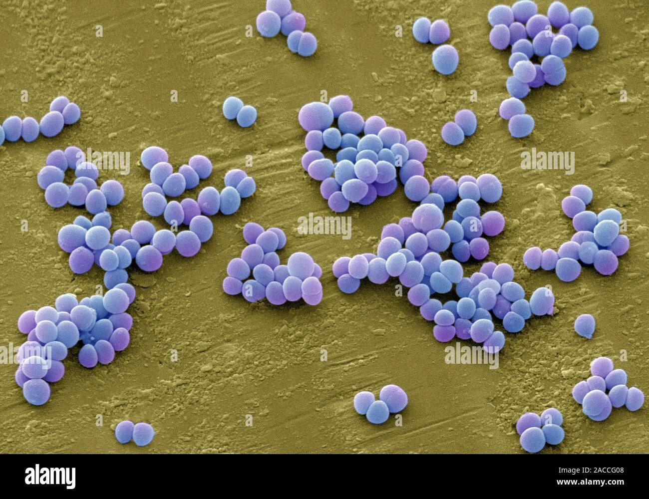 MRSA-Bakterien, farbige Scanning Electron Micrograph (SEM). Methicillin ...