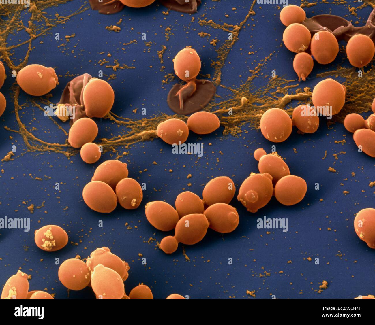 Candida albicans. Farbige Scanning Electron Micrograph (SEM) der Pilz ...