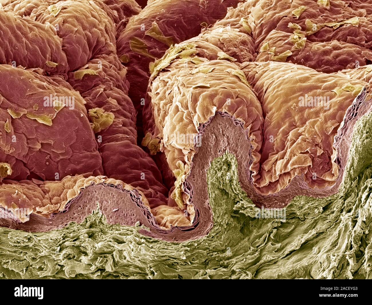 Gewebe der Haut. Farbige Scanning Electron Micrograph (SEM) der Freeze ...