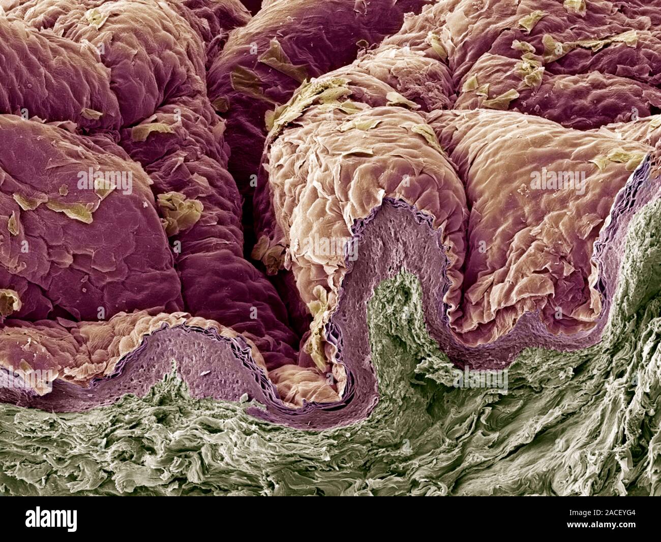 Gewebe der Haut. Farbige Scanning Electron Micrograph (SEM) der Freeze ...