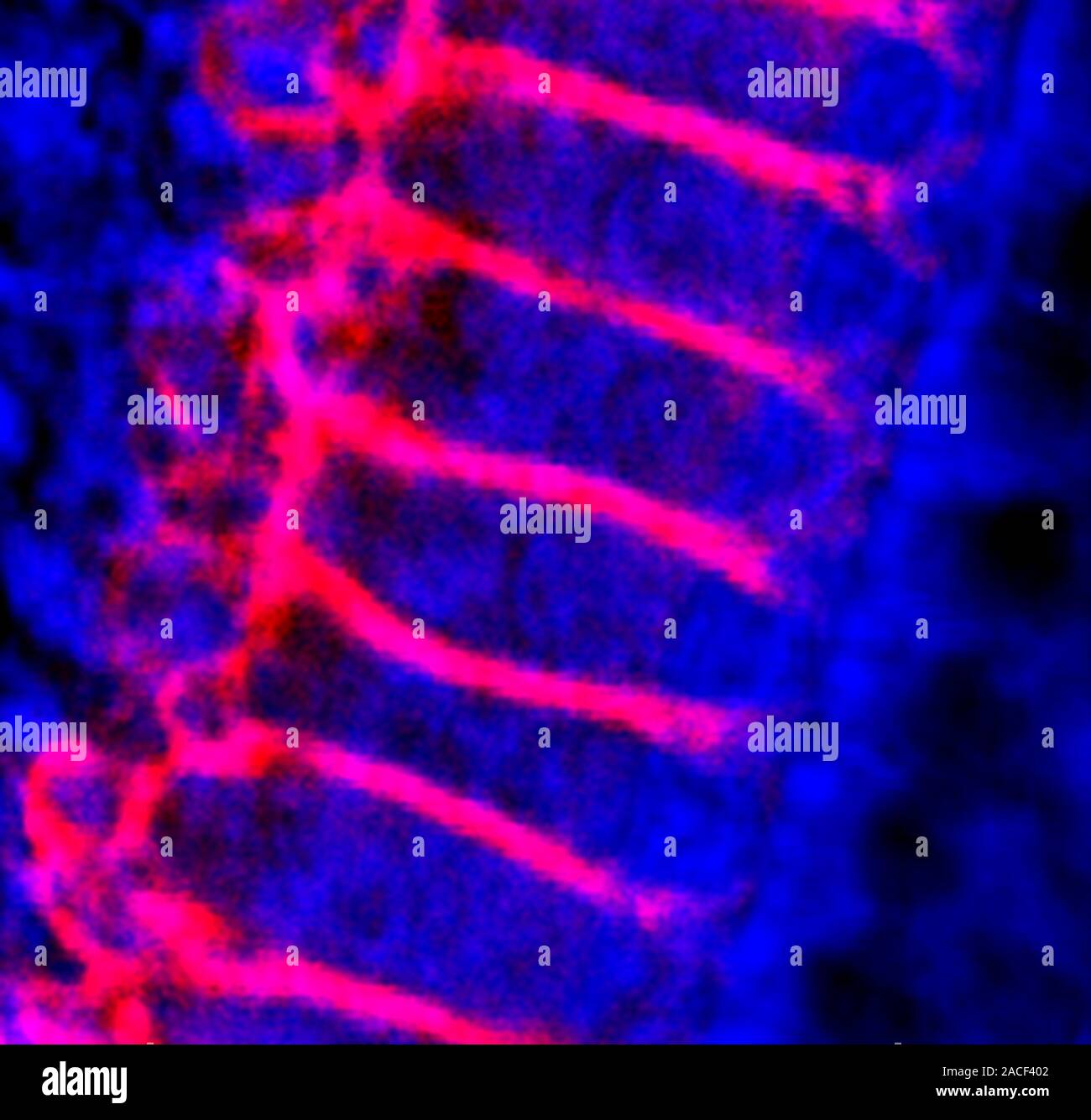 Haarzellen des Innenohrs. Das Licht einer Leuchtstoffröhre Schliffbild der von Haarsinneszellen ...