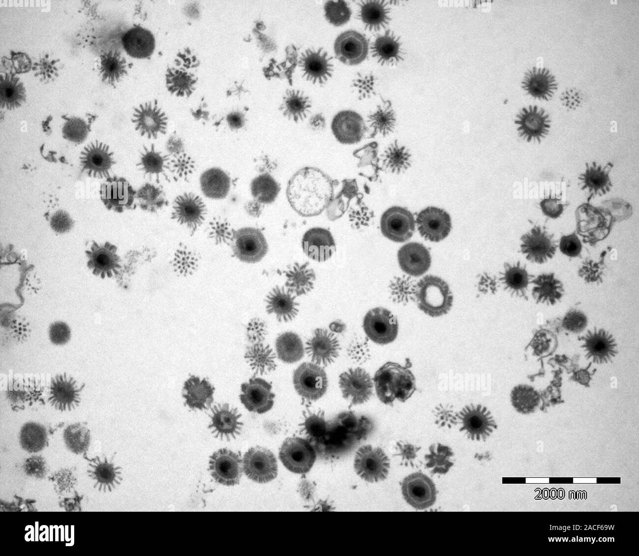 Mimivirus. Transmission Electron Micrograph (TEM) von Acanthamoeba ...