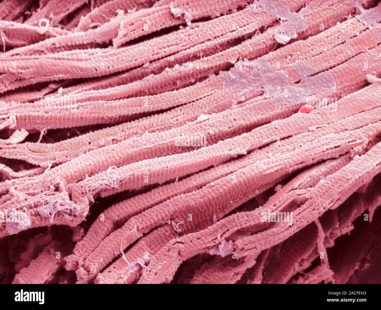 Herz Muskelfasern. Farbige Scanning Electron Micrograph (SEM) des ...