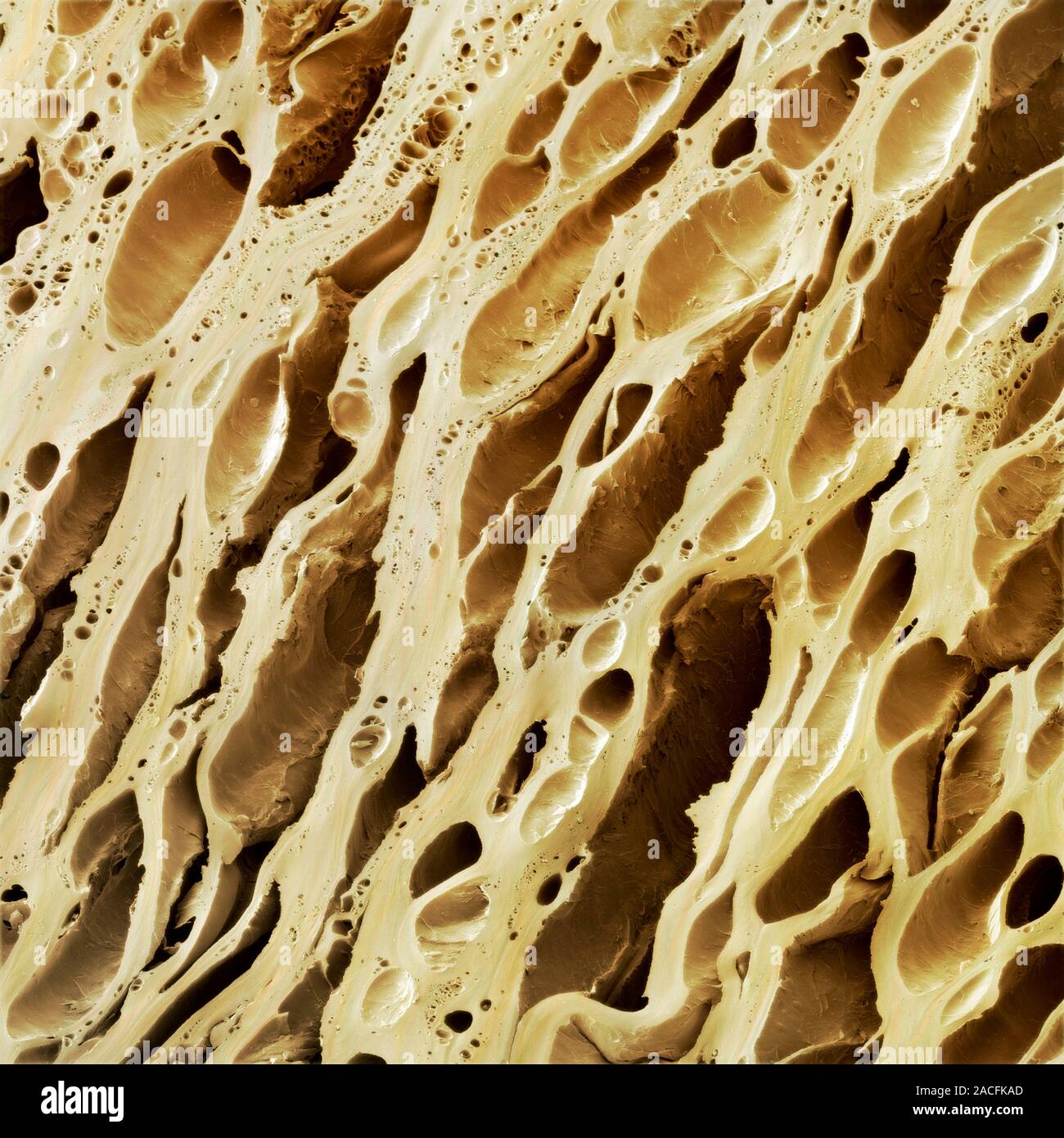 Schafe Horn. Farbige Scanning Electron Micrograph (SEM) einen ...