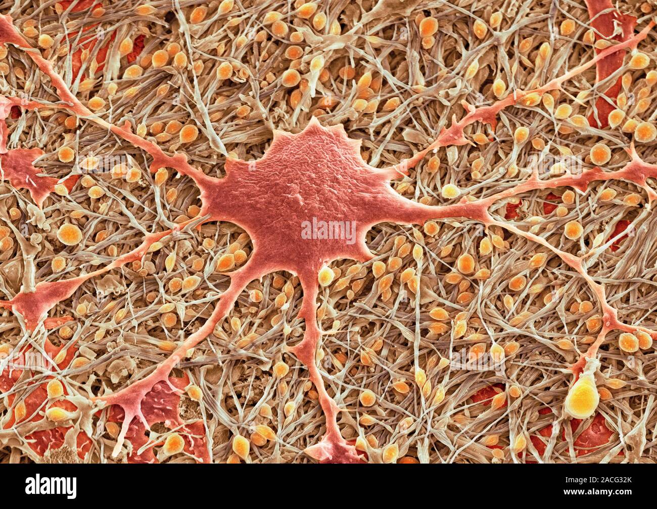 Gliazellen. Farbige Scanning Electron Micrograph (SEM) der Gliazellen ...