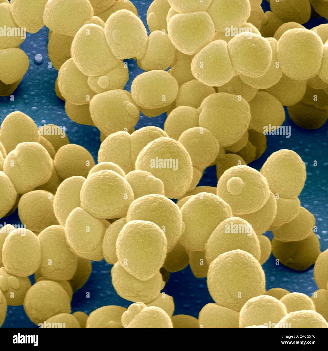 Staphylococcus aureus-Bakterien. Farbige Scanning Electron Micrograph ...