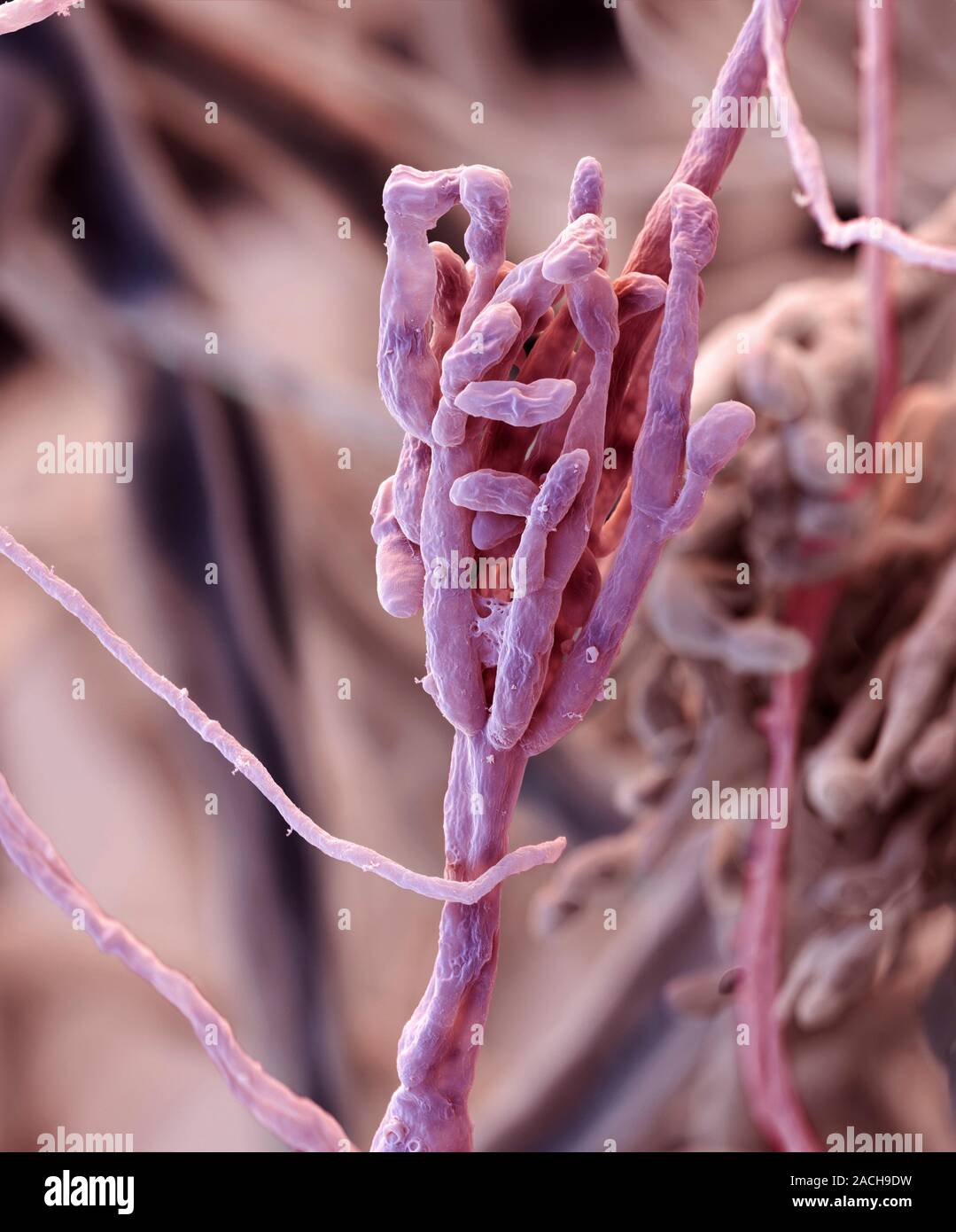 Gliocladium roseum. Farbige Scanning Electron Micrograph (SEM) der ...