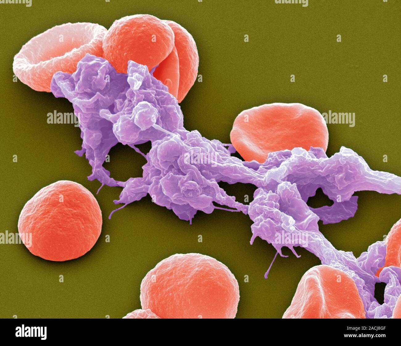 Rote Blutkörperchen und Blutplättchen. Farbiges scannen electon ...