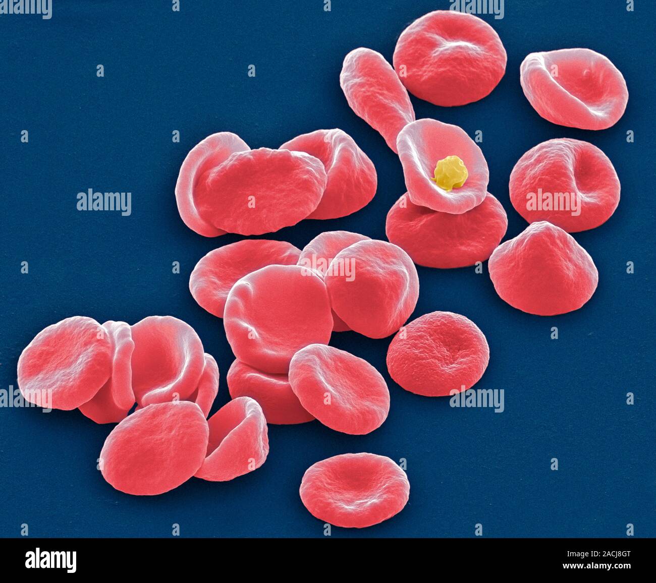 Die roten Blutkörperchen. Farbige Scanning Electron Micrograph (SEM ...