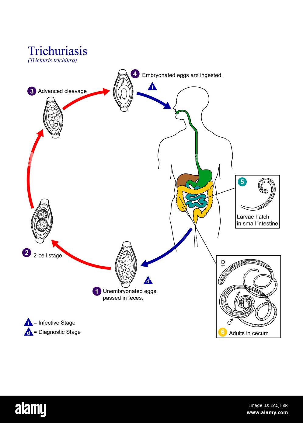 Madenwurm Lebenszyklus. Grafik, die den Lebenszyklus der parasitären Nematoden (Rundwürmer ...