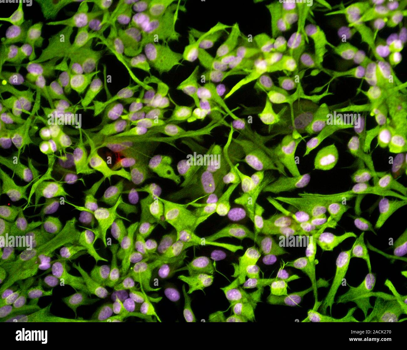 Astrocyte Zellen des Gehirns. Fluoreszenz Licht Aufnahme von astrocyte ...