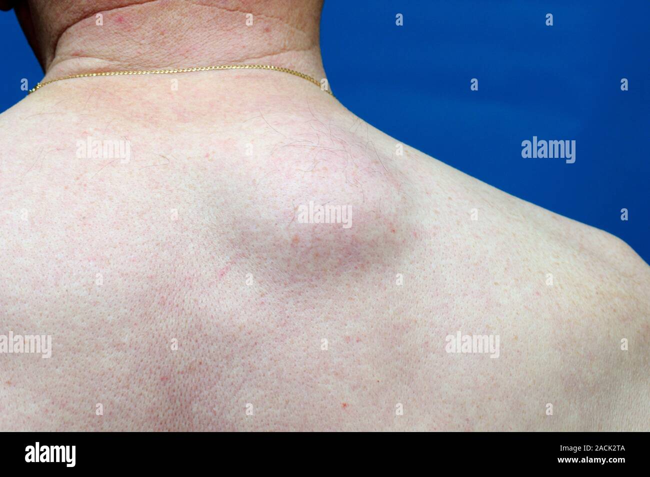 Nicht für den Einsatz im Fernsehen nicht für die Verwendung im ...