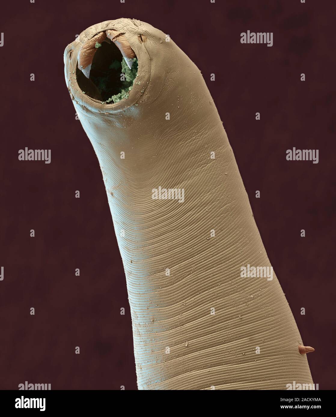 Hookworm. Farbige Scanning Electron Micrograph (SEM) der Kopf der parasitären nematode ...