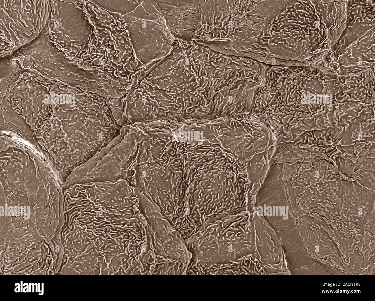 Keratinozyten durchlaufen Hautzellen. Farbige Scanning Electron ...