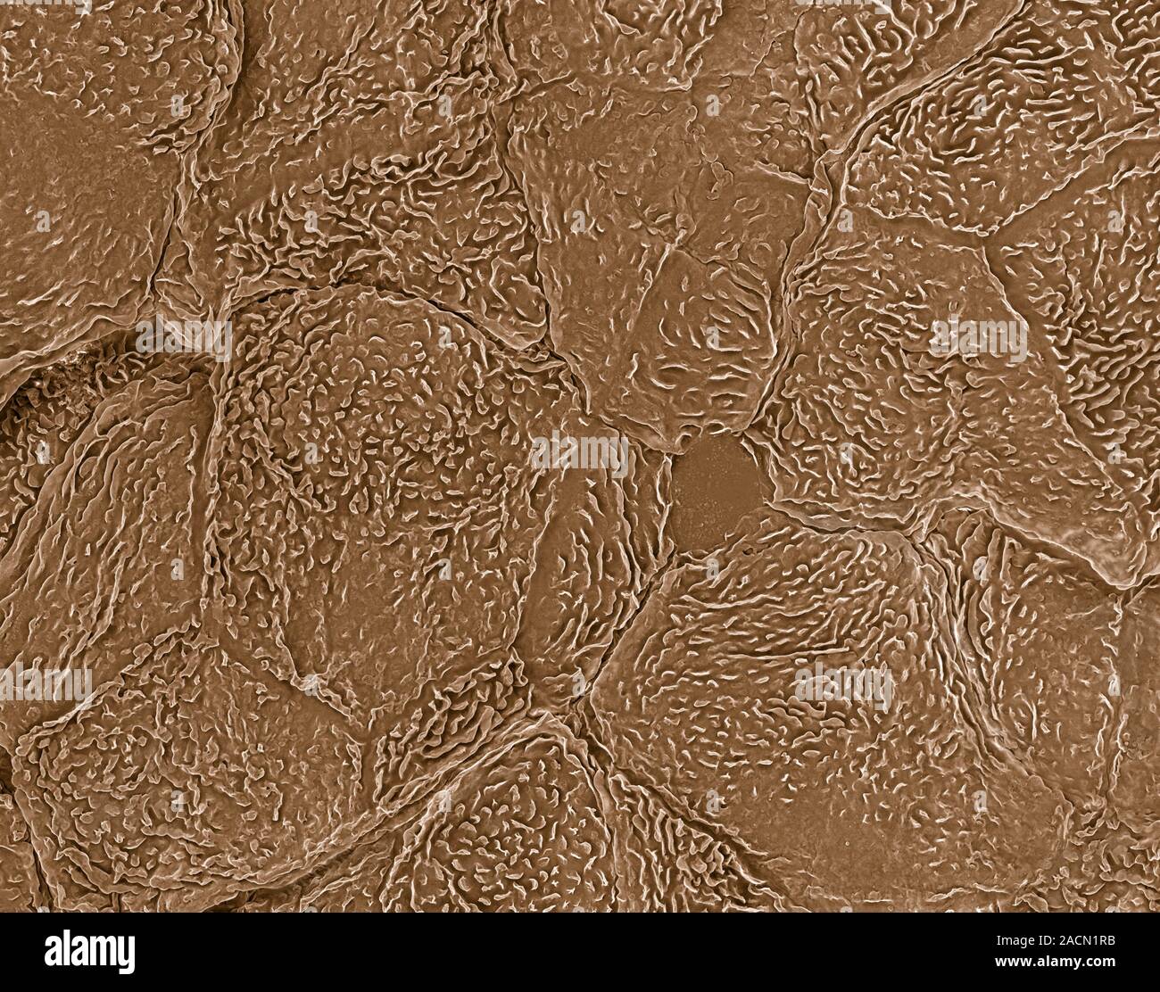 Keratinozyten durchlaufen Hautzellen. Farbige Scanning Electron ...