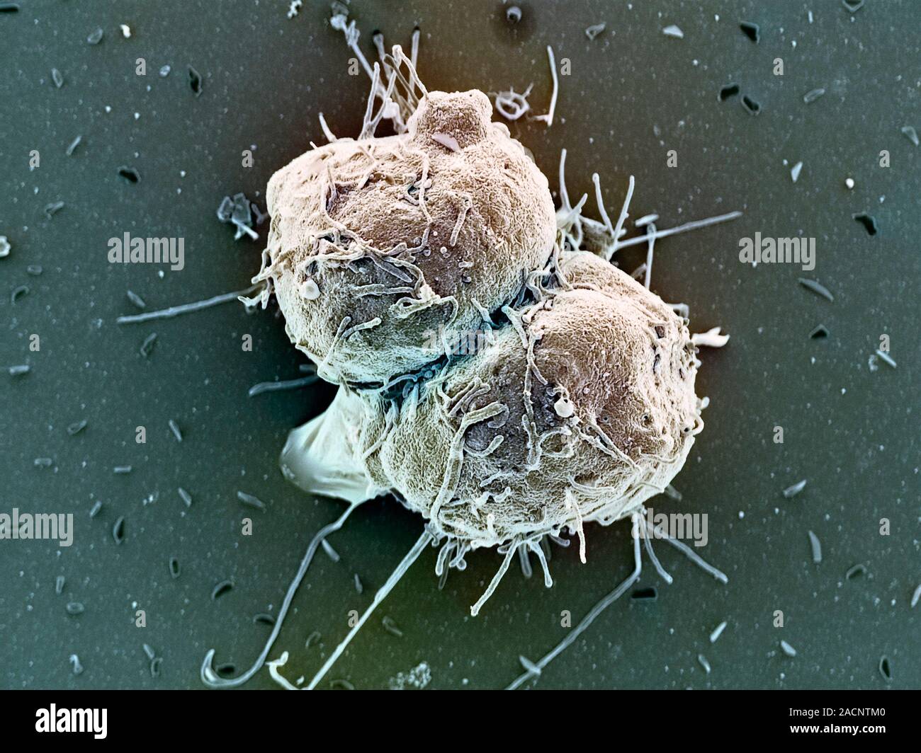 Knochenmark Stammzellen. Farbige Scanning Electron Micrograph (SEM) von ...