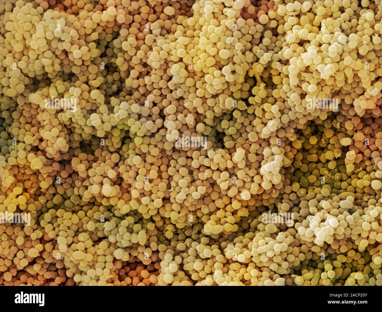 Lactococcus sp. Bakterien. Scanning Electron Micrograph (SEM) des ...