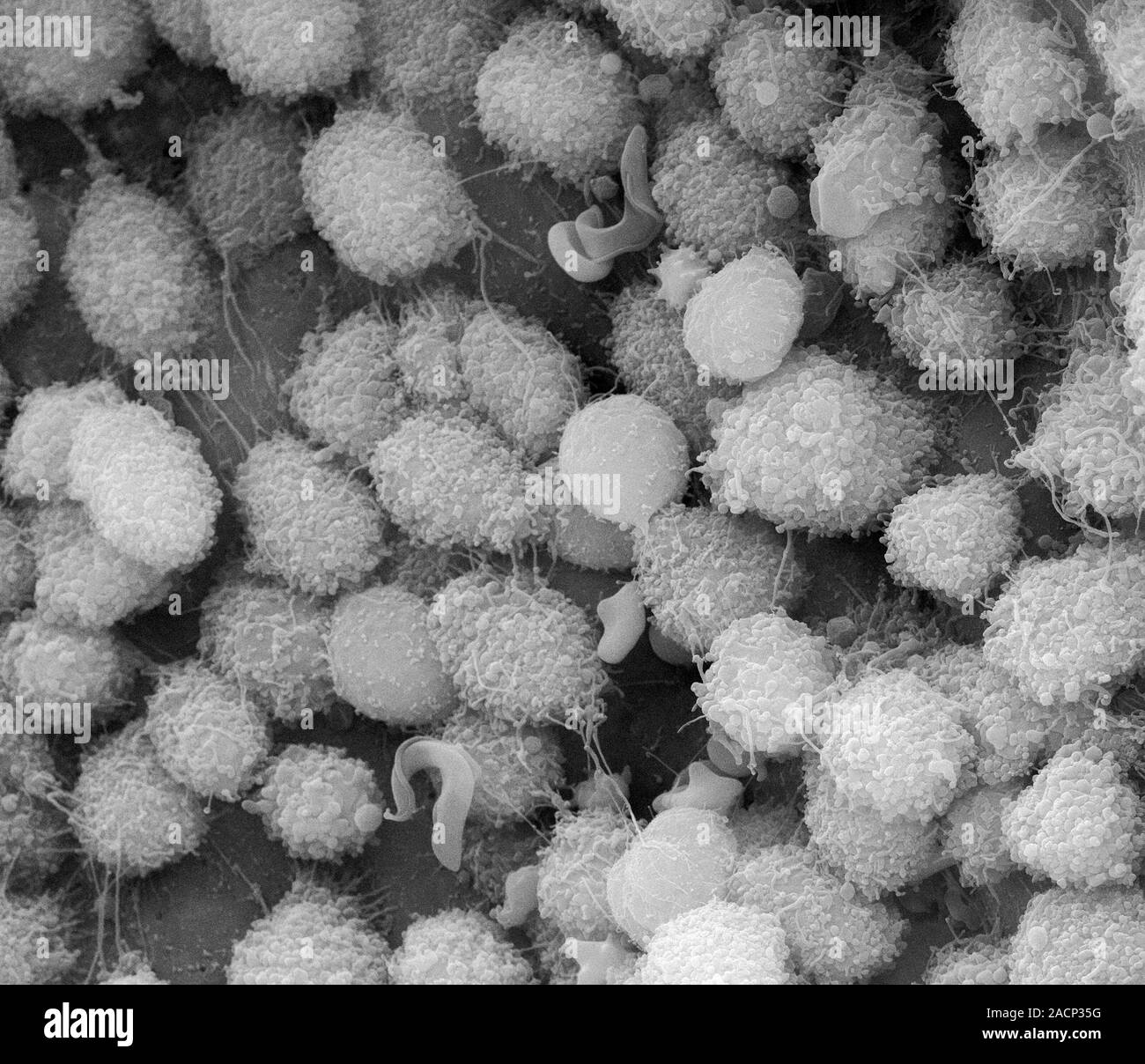 Schlafkrankheit Parasiten. Scanning Electron Micrograph (SEM) von dem ...
