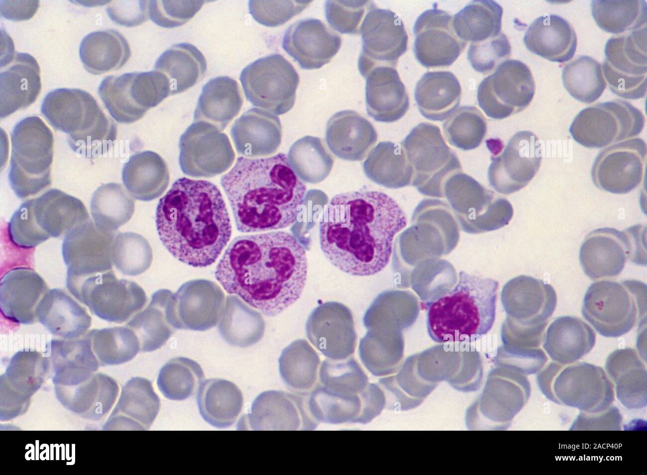 Knochenmark Blutzellen, Licht schliffbild. Knochenmark ist einer der ...