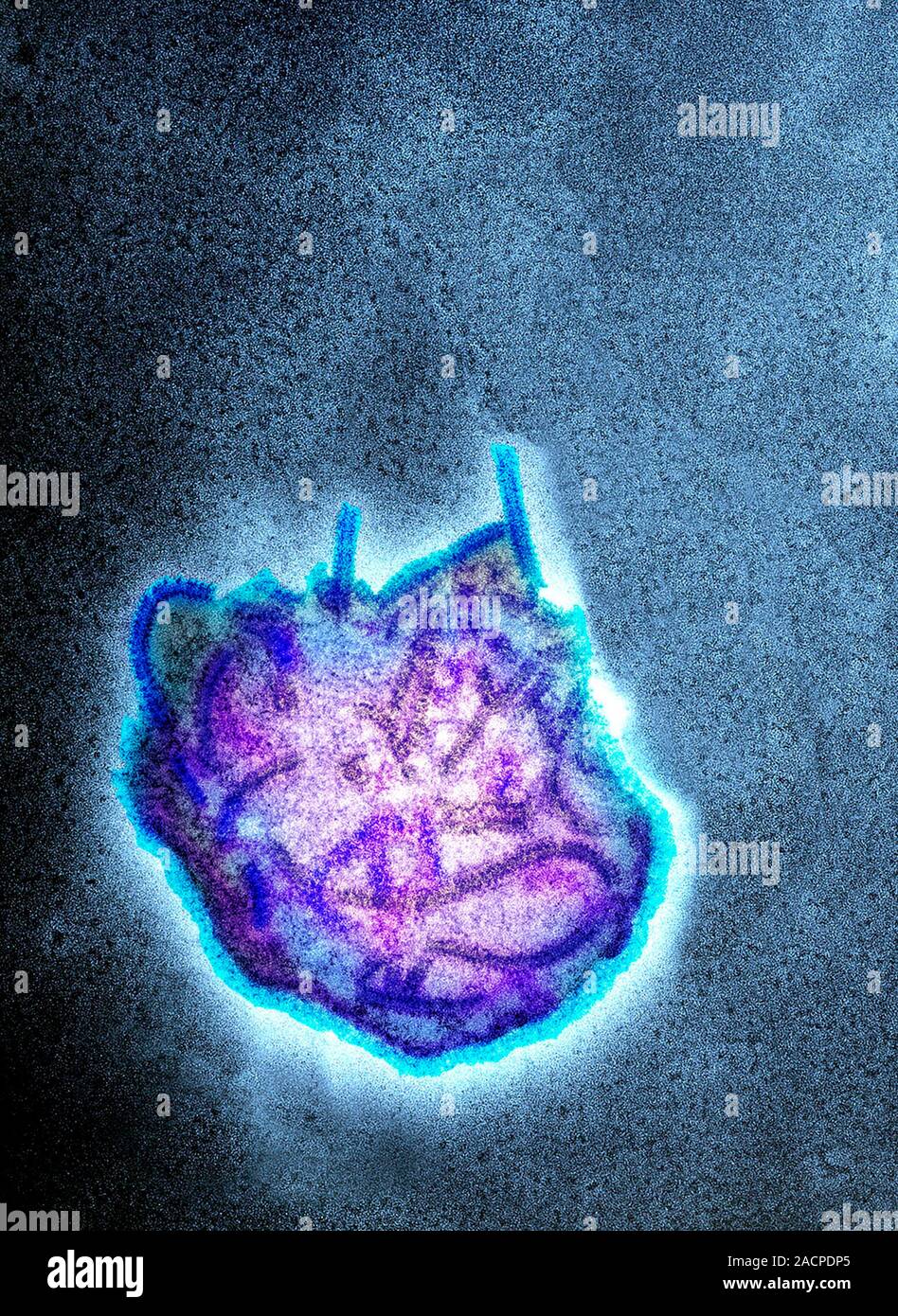 Masern Virus Partikel, farbige Transmission Electron Micrograph (TEM ...