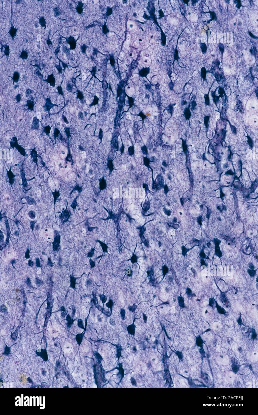 Gehirn Gliazellen. Licht Aufnahme eines Abschnitts durch Hirngewebe ...
